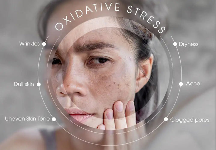 Oxidative Stress, its effects on Skin, and how to tackle it? - Glutone